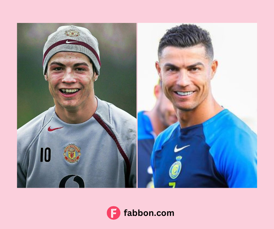 Did Cristiano Ronaldo Have Plastic Surgery? Doctors Say Yes! | Fabbon