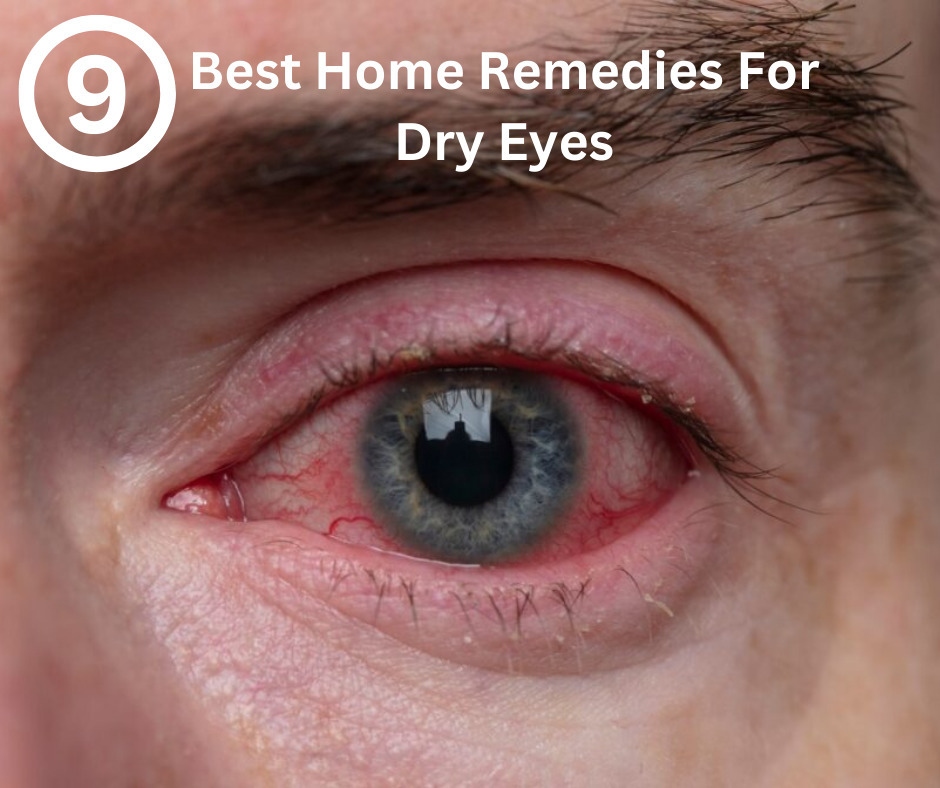 9 Best Home Remedies For Dry Eyes | Fabbon