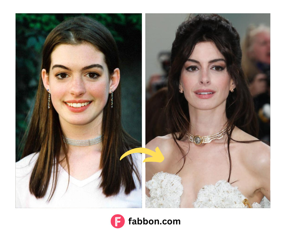 Is Plastic Surgery Anne Hathaway's Secret To Timeless Beauty? | Fabbon
