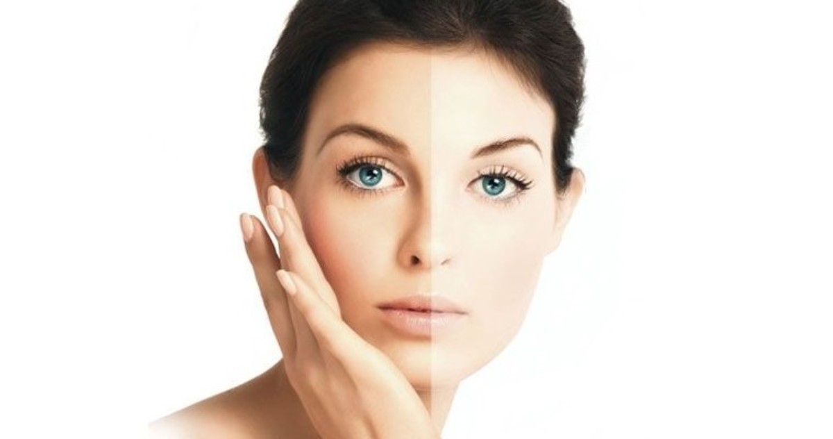 6 Best Home Remedies For Skin Whitening | Fabbon