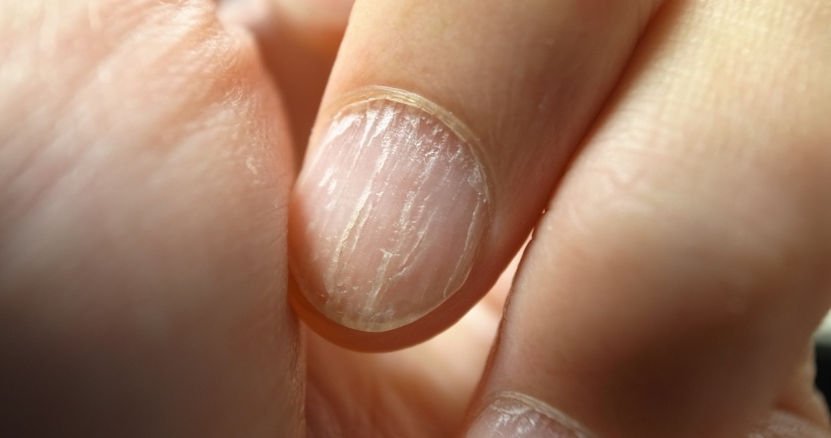 9 Things Your Nails Reveal About Your Health | Fabbon